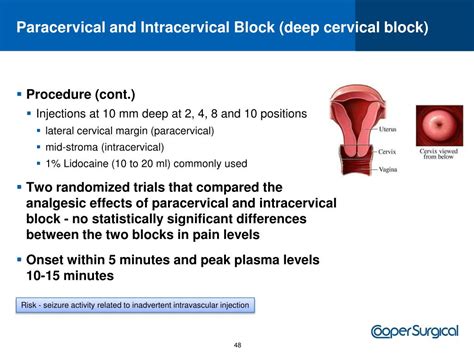 Ppt Global Endometrial Ablation Powerpoint Presentation Free Download Id 1028479