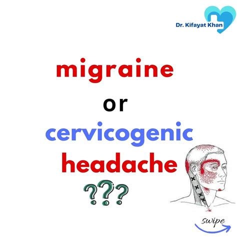 Dr Kaif Physio A Cervicogenic Headache Cgh Presents As