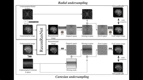 Regularised Residual Learning For MR Image Reconstruction Of Undersampled Cartesian And Radial