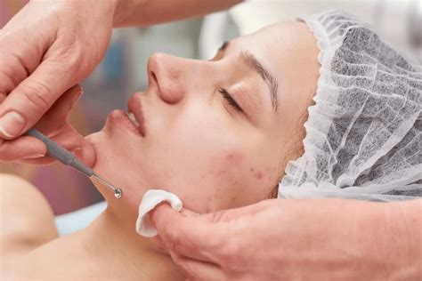 Best Acne Treatment Doctor In Rohini Delhi