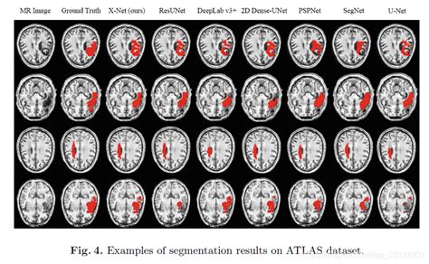 医学图像分割 （miccai 2019）selective Feature Aggregation Network With Area Bo Csdn博客