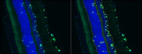 Retina Analysis Toolkit