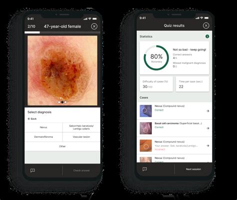 Melatech Advancing Ai Software In Public Health