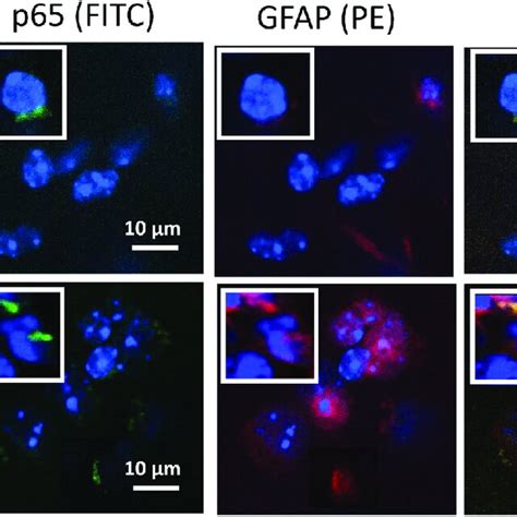 Representative Images From Cerebral Cortex Of A Control Mouse And One Download Scientific