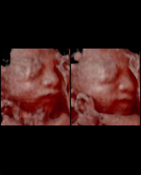 임신 허니제이 아기 3d 초음파 사진 공개신기방기 네이트 연예