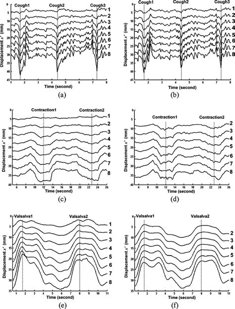 The Displacement Of Eight Evenly Spaced Positions On The Anterior And Download Scientific
