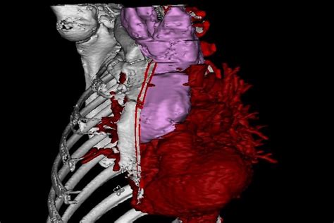 General Surgery 3d Guided Surgery