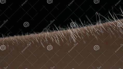 Macro Shot Of Hair Standing On End Against A Dark Background Stock