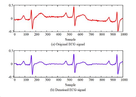 Denoising Results Of Method Using Lifting Wavelet Transform And Hilbert Download Scientific