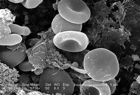 Free Picture Surface Area Hemoglobin Filled Cells