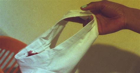 Bleeding After A C Section What To Expect