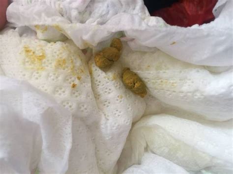 宝宝大便干 宝宝大便干结羊粪状 随意云