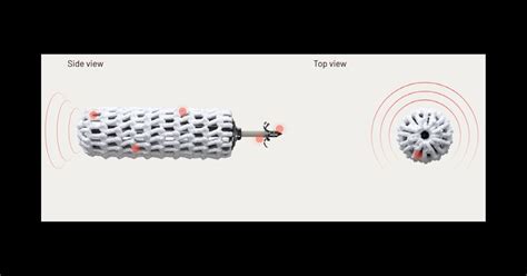 Fda Approves Leadless Crt Device For Heart Failure Cardiovascular