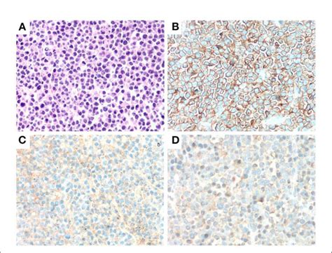 Figure E Immunohitsochemical Ihc Analysis Of The Morphology Of Left Download Scientific