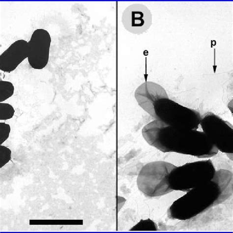 Transmission Electron Micrographs Of A Bacillus Subtilis Spore A And