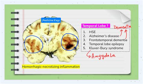 Medicine Memory And Emotions Are Functions Of Temporal Lobe Important Disorders Affecting The