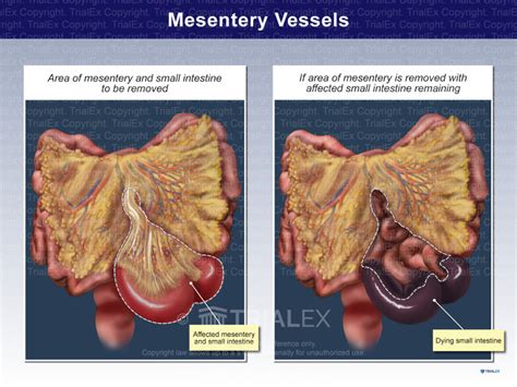 Mesentery Vessels Trialquest Inc