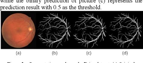 Figure 1 From Retinal Microvascular Segmentation Algorithm Based On Multi Scale Attention