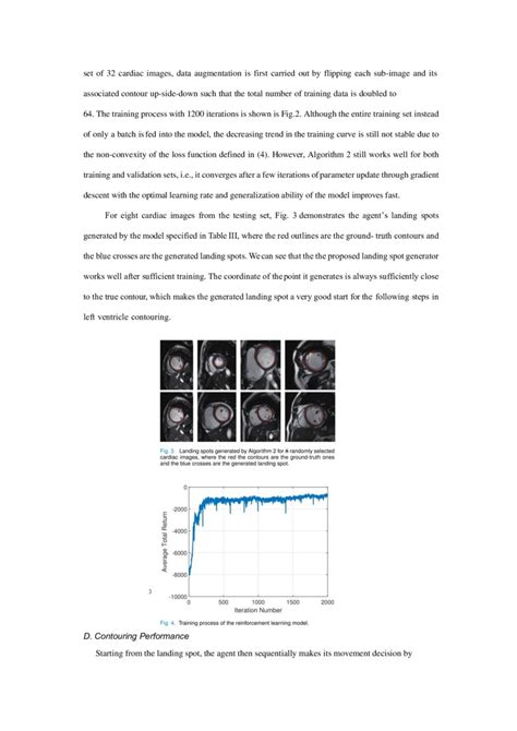 Left Ventricle Contouring In Cardiac Images Based On Deep Reinforcement