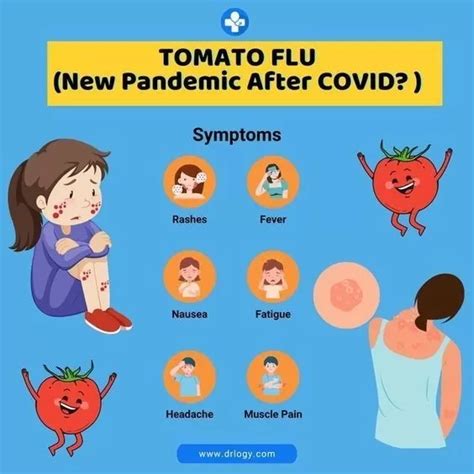 15 Symptoms Of Tomato Flu You Must Know With Treatment And Prevention