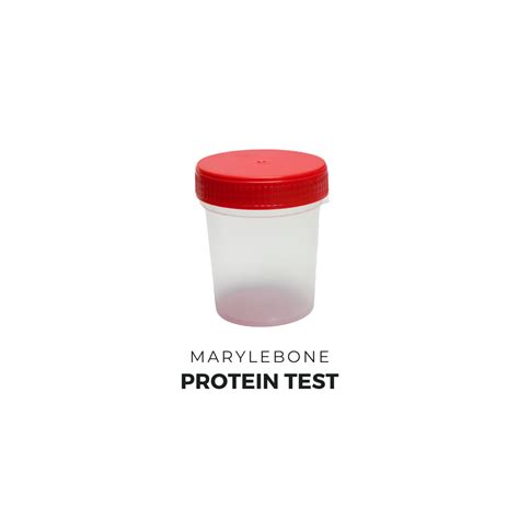 Protein Test Marylebone Diagnostic Centre