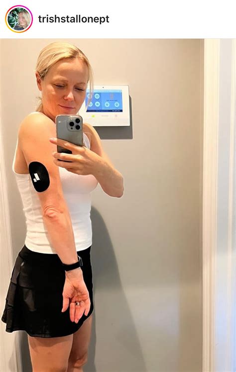 Continuous Glucose Monitoring