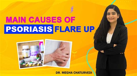 Main Causes Of Psoriasis Flare Up How To Prevent Psoriasis From