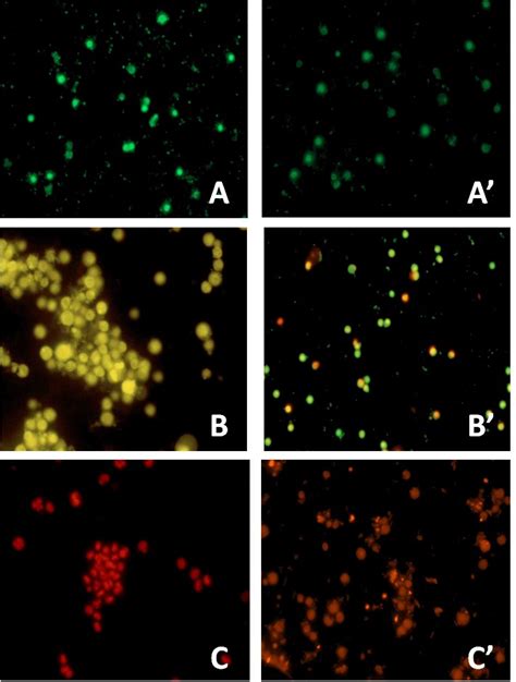 Morphological Observation With Acridine Orange And Ethidium Bromide Download Scientific Diagram