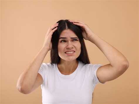 7 Natural Diy Remedies For Psoriatic Scalp Treatment For Quick Relief