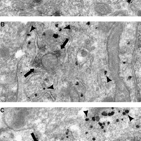 Electron Micrographs Of Cell Bodies Immunogold Labeled For Pv Or Cr