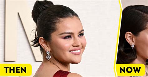 Selena Gomez Face Surgery