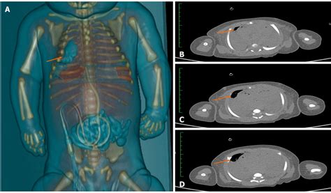 Results Of Imaging Examination A Total Body Postmortem Computed Download Scientific Diagram