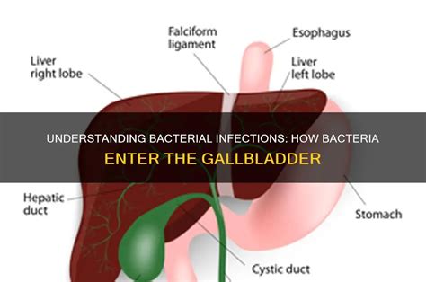 Understanding Bacterial Infections How Bacteria Enter The Gallbladder