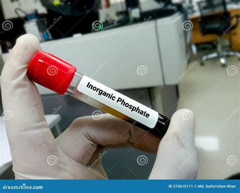 Inorganic Phosphate Test Stock Image Image Of Medicine 275615111
