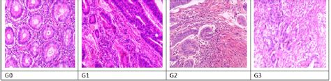 figure 1 from of cnn methods for classifying colon histopathological images 70538 semantic