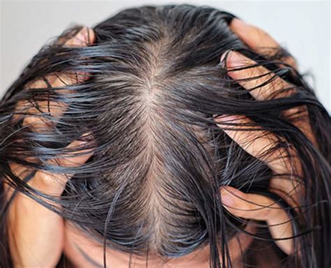 Greasy Hair Hacks Without Washing Greasy Hair Hacks Without Washing Herzindagi