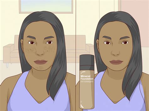 3 Ways To Get Rid Of Dark Spots On Your Face WikiHow