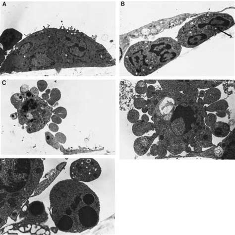A Series Of Transmission Electron Micrographs Illustrating Different