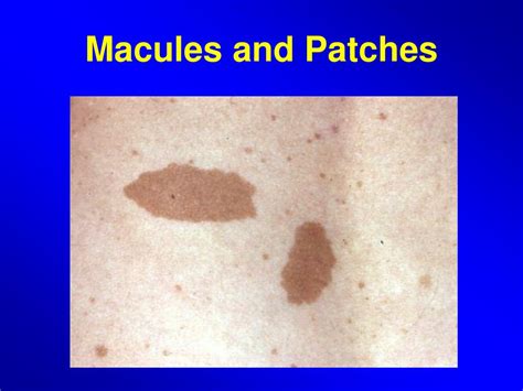 Ppt Introduction To Dermatology Powerpoint Presentation Free Download Id 625999