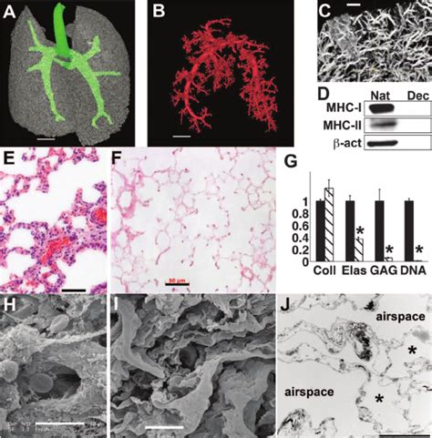 Characterization Of Acellular Lung Matrix A 3d Micro Ct Of The