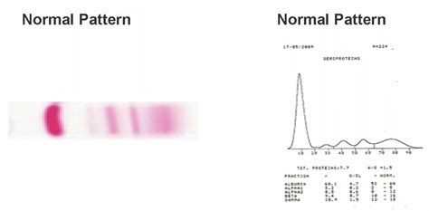 Pie Chart Showing Percentage Of Different Spep Pattern