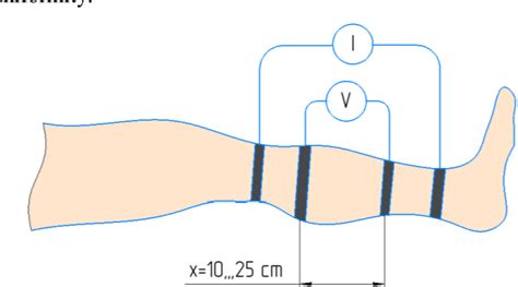 Figure 1 From Influence Of Arterial Blood Flow On Impedance