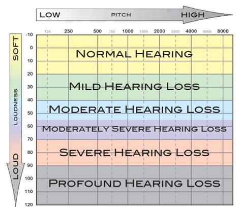 Audiograms Audiogram For Berard Ait Audiogram Hyper Acute Hearing