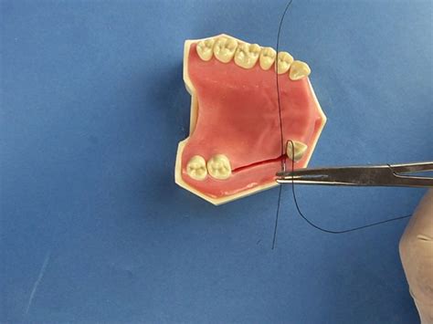 Continuous Locking Suture Stuart Orton Jones