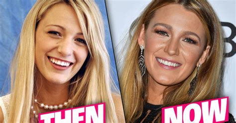 Blake Livelys Nose Job Rumors Secret High School Photos Uncovered