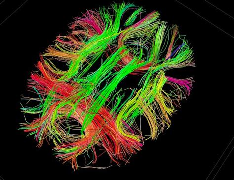 The Human Connectome Project Is Turning Brain Scans Into The New