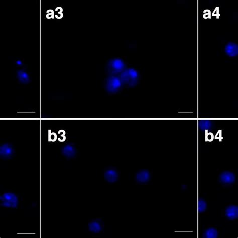 Dapi Staining Of Microspores A Sterile Condition B Fertile Condition Download Scientific