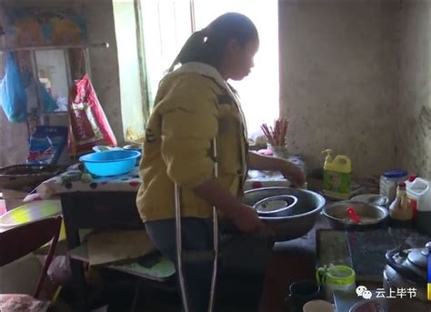 命运多舛这位高位截肢的毕节女孩用坚强感动所有人 搜狐大视野 搜狐新闻