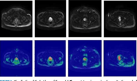 figure 1 from prostate segmentation in mri using transformer encoder and decoder framework