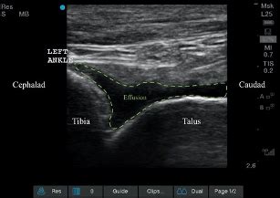 Educational Blog — Maimonides Emergency Medicine Residency